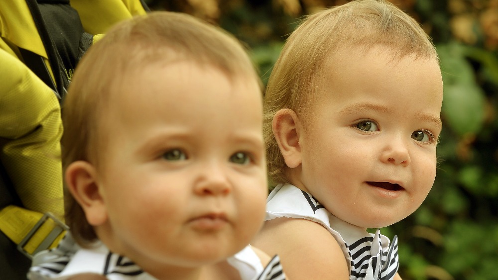 Separated Conjoined Twins Celebrate First Birthday Itv News